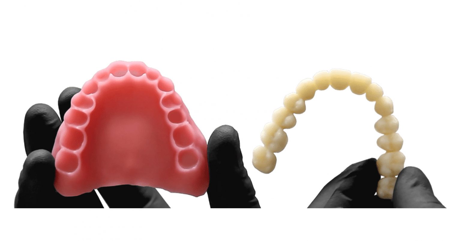 Full Dentures - Diamond Denture Studio